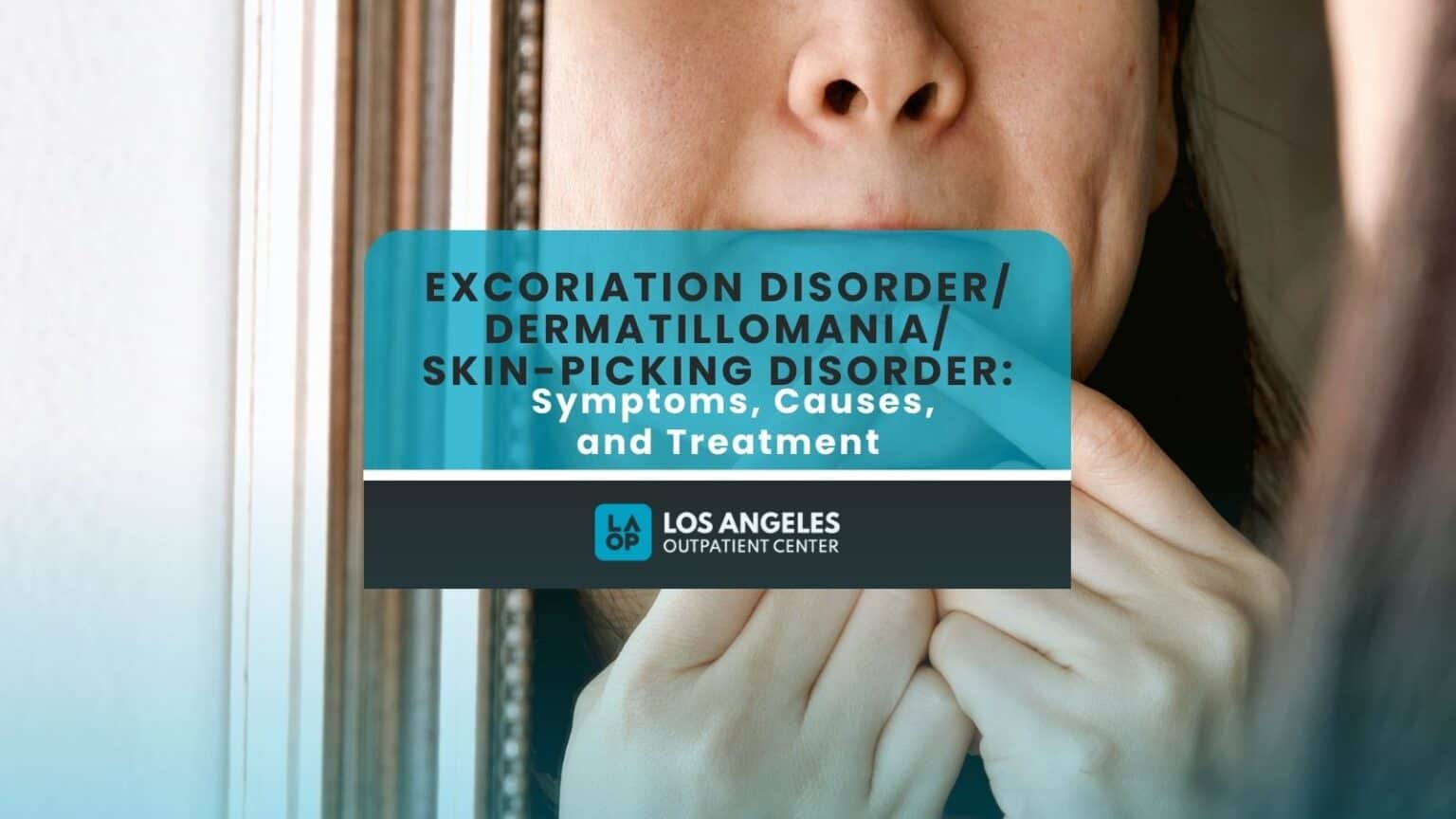 Excoriation Disorder/ Dermatillomania/ Skin-picking Disorder: Symptoms ...