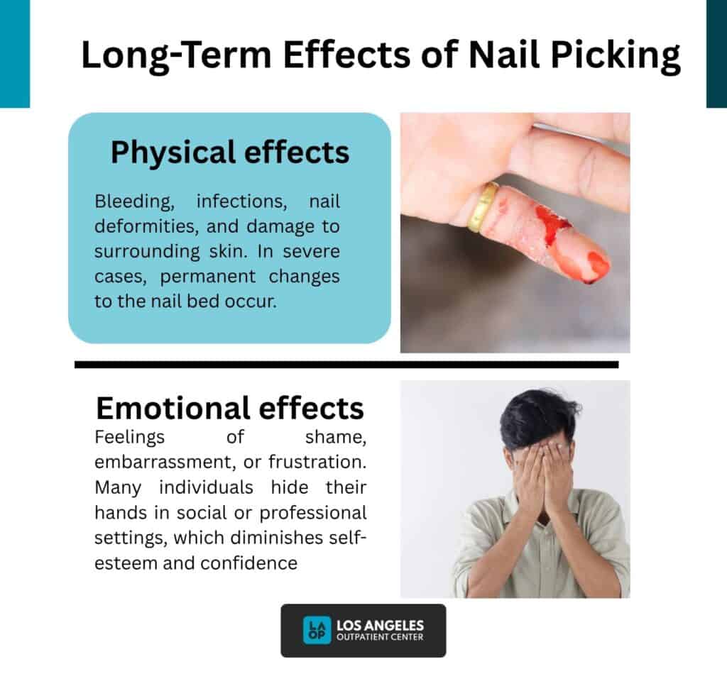 Anxiety and Nail Picking: I Can’t Stop Picking My Nails - Los Angeles ...