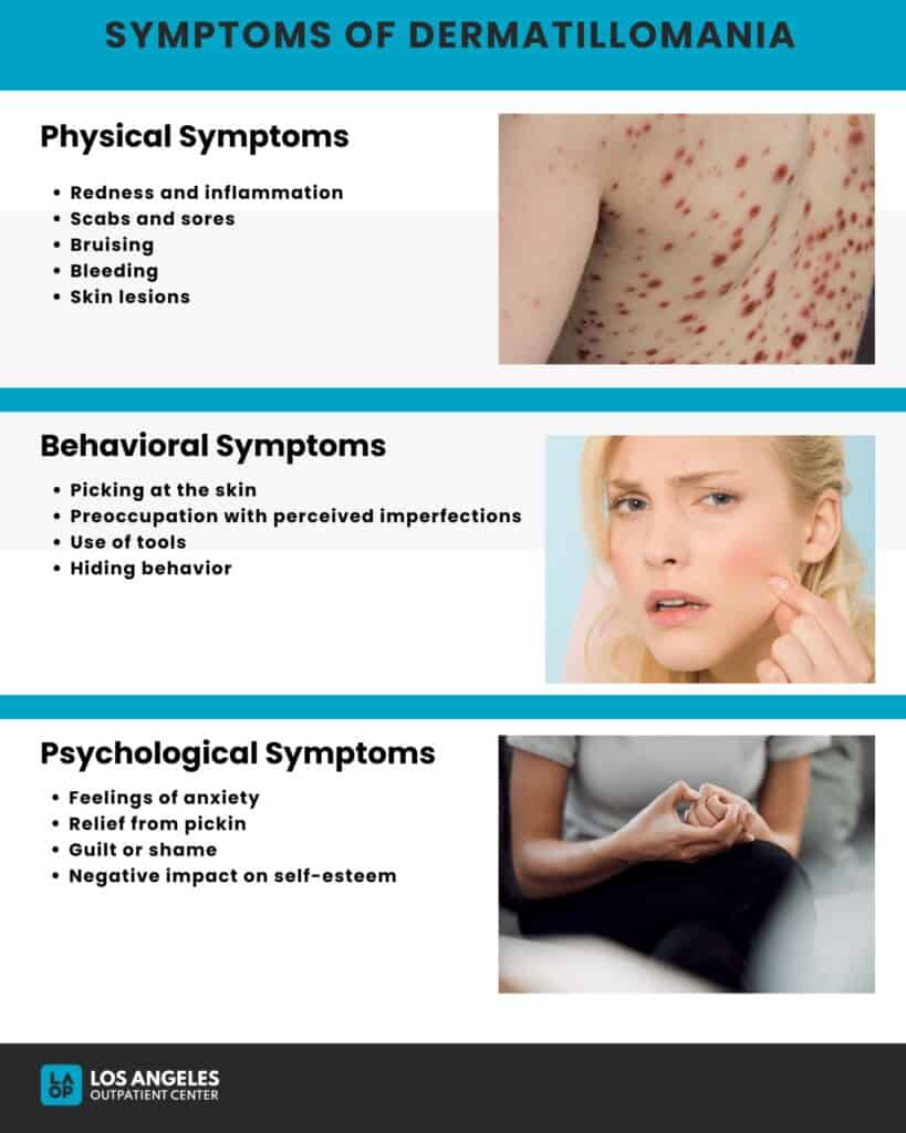 Scab Picking Disorder What Is Skin Picking Disorder 